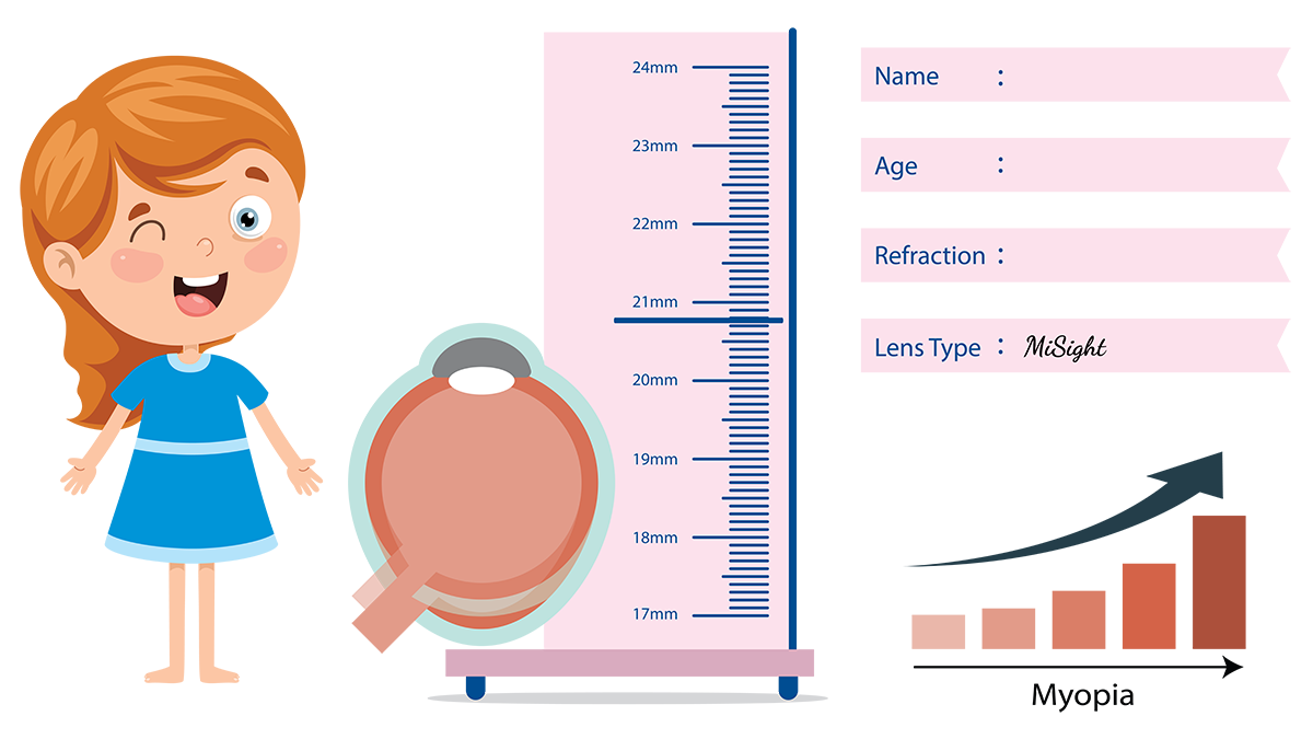 Growth Charts To Track Progression Of Myopia MiSight Myopia Profile